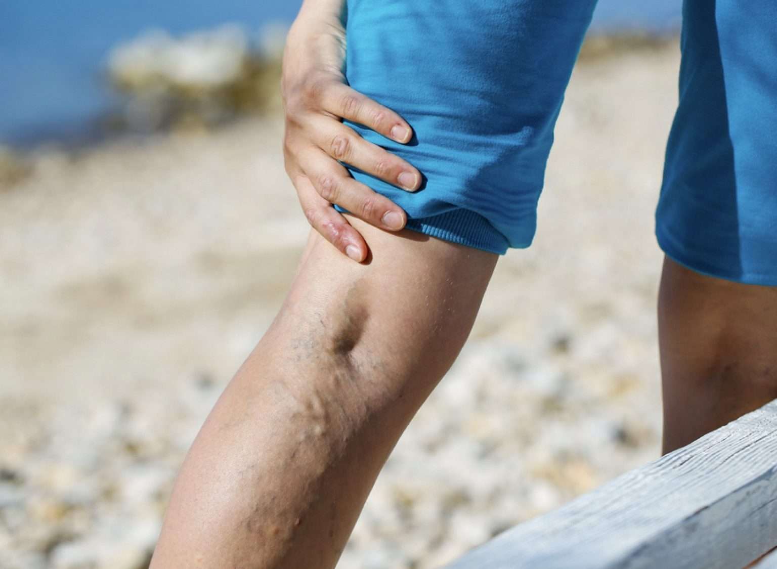 Spataderen Voorkomen: De 7 Beste Tips! - Mynd